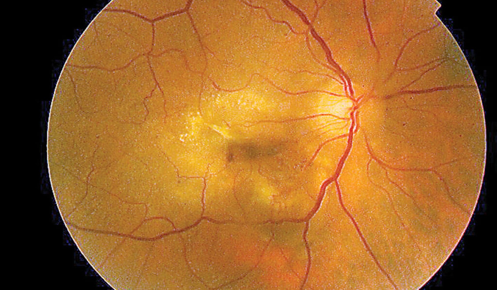 Is Waking Up With Red Eyes A Serious Health Problem?